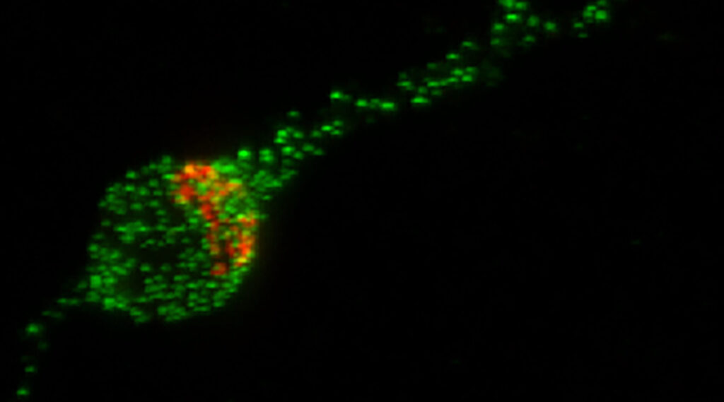 New UW-Madison study allows scientists to test therapeutics for rare ... New UW-Madison study allows scientists to test therapeutics for rare ...